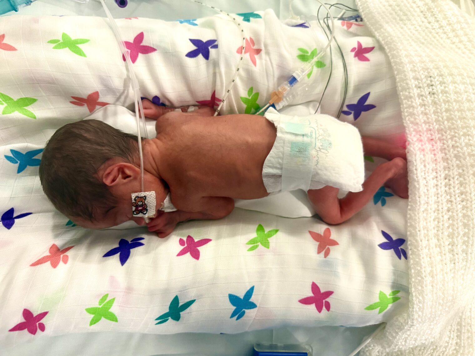IVH Neuroprotection Bundle – Neonatal Unit