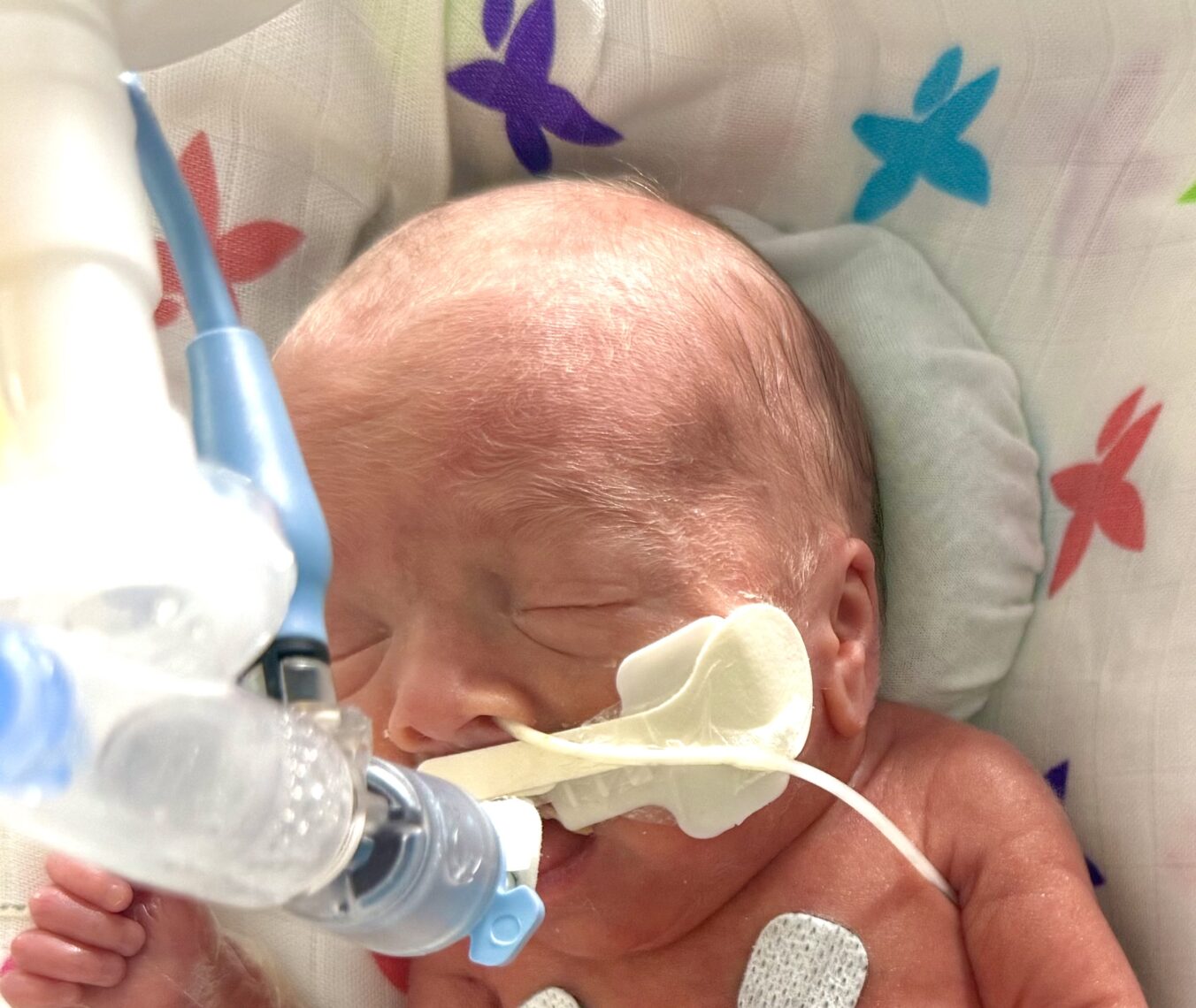 IVH Neuroprotection Bundle – Neonatal Unit