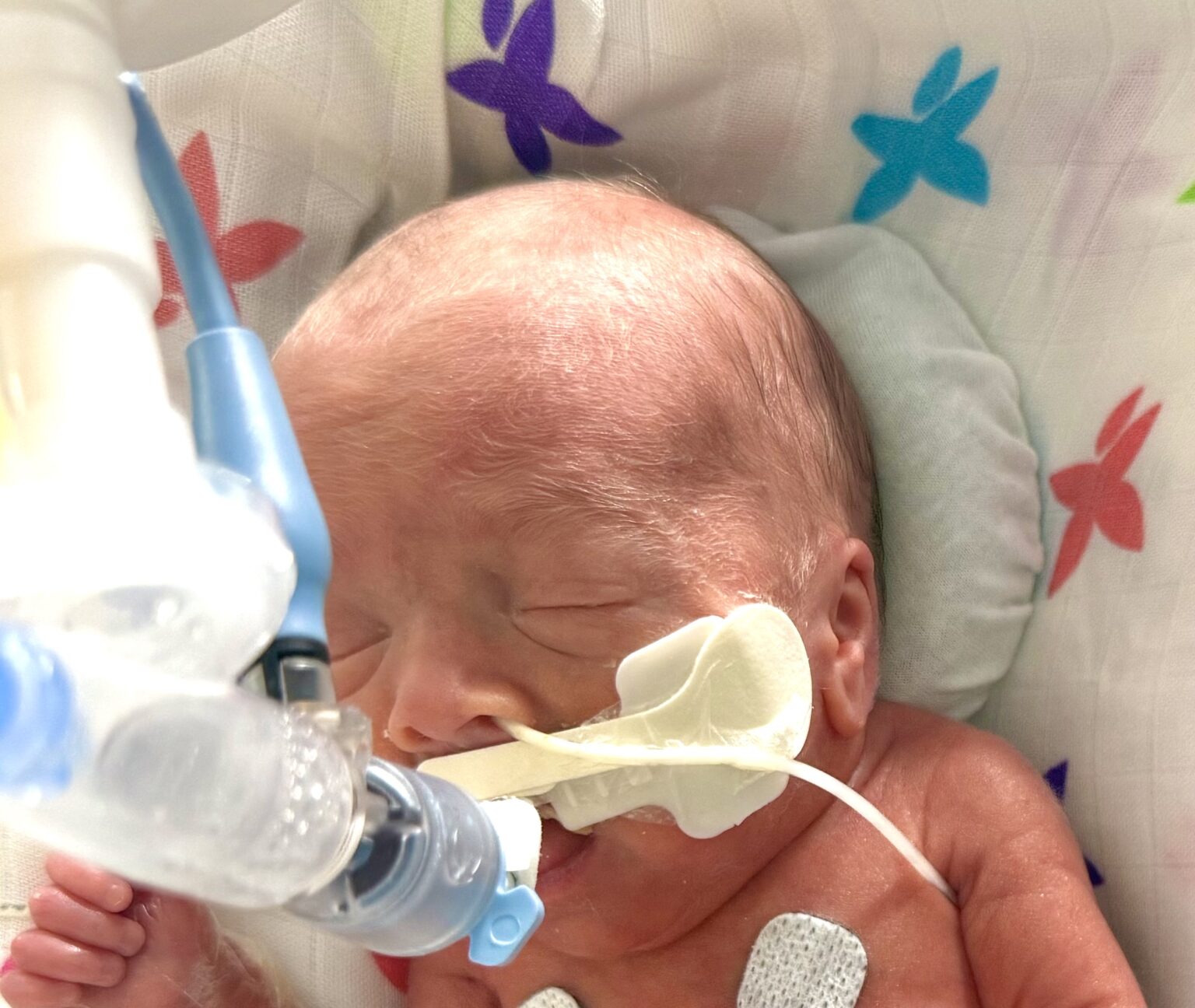 IVH Neuroprotection Bundle – Neonatal Unit