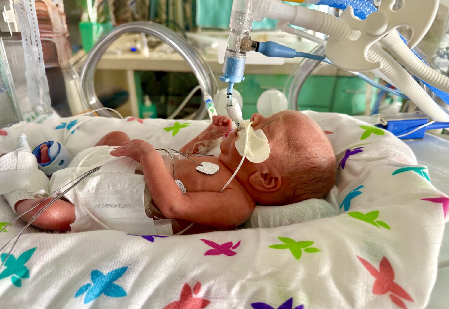 IVH Neuroprotection Bundle – Neonatal Unit