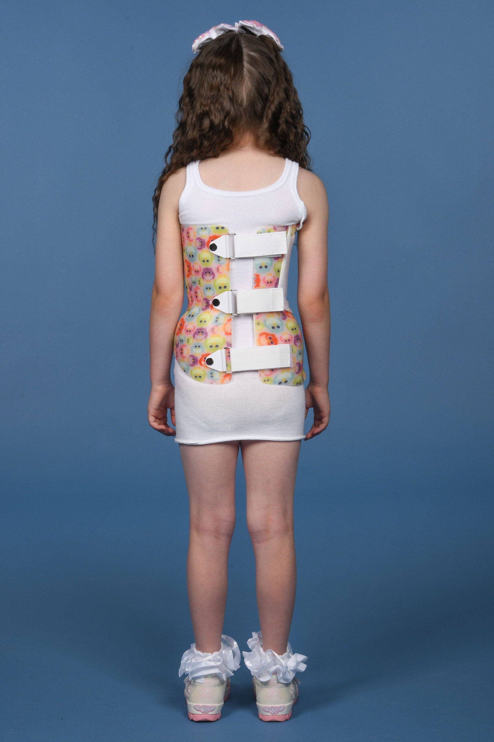 Corrective braces – Scottish National Spine Service